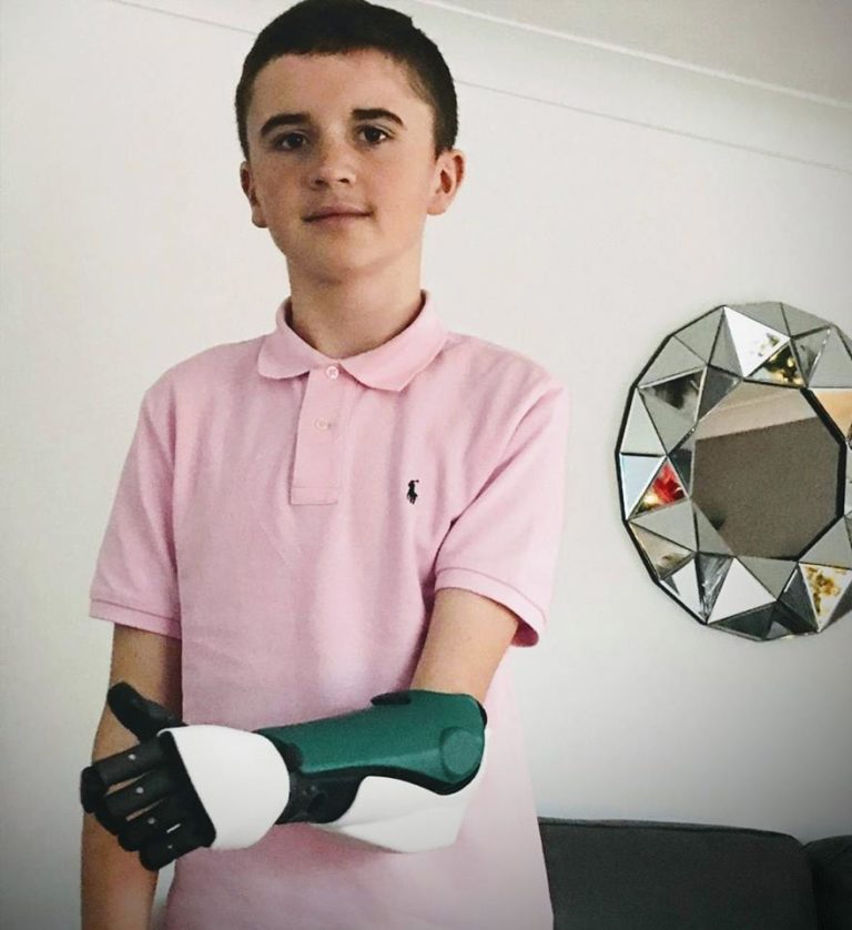 Ryan's Hero Arm - Finding your Feet
